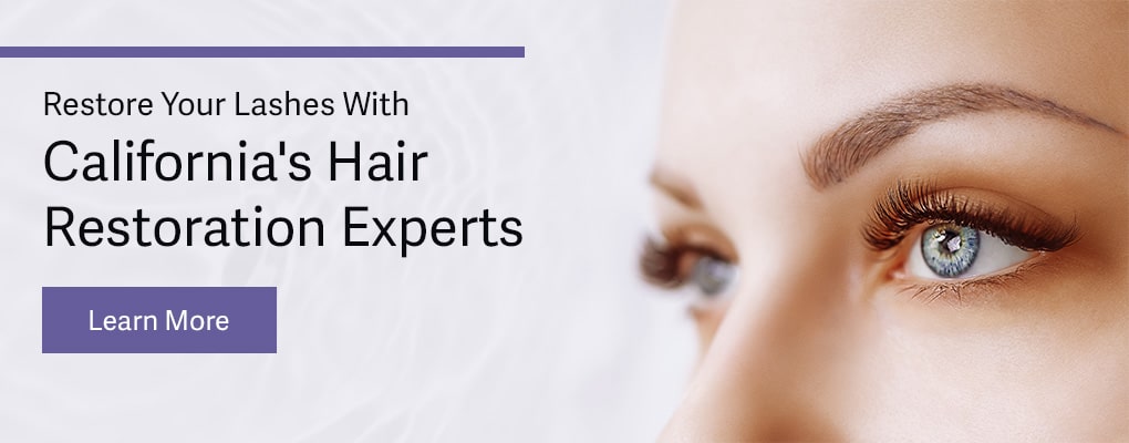 Eyelash Transplant Pros & Cons | Permanent Lash Solutions