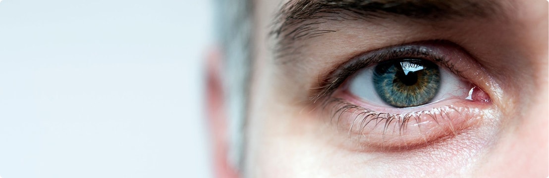 Eyelash Transplants in California | Get Full Lashes | iHair